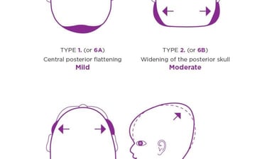 What is Brachycephaly and What Causes it?