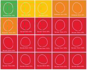 How Do I Know If My Baby Has a Severe Flat Head?